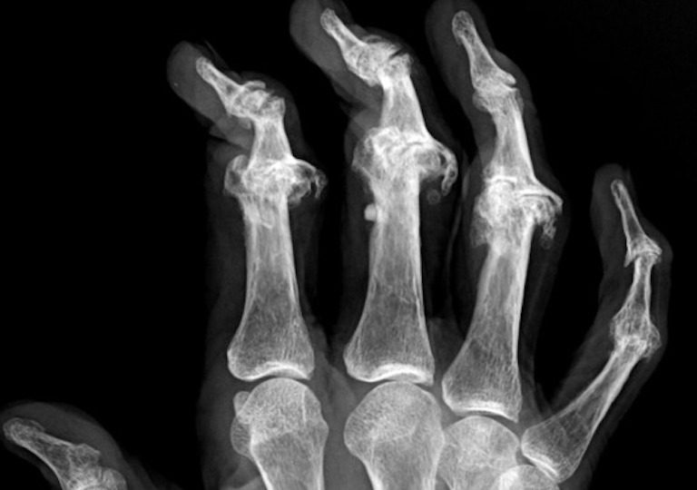 Helping Hands Rheumatology – Dr. Sonam Joshi | Rheumatologist